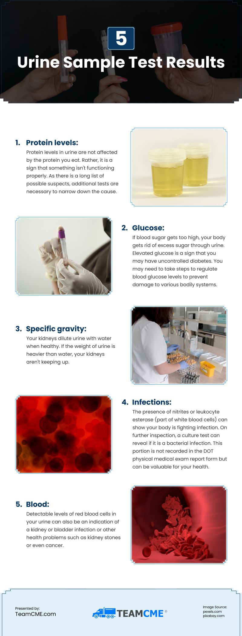 5 Urine Sample Test Results Infographic